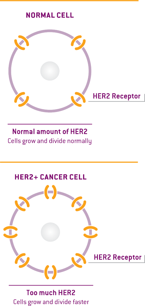 Breast Cancer Cells Vs Normal Cells Breast Cancer HER2+ Overview And